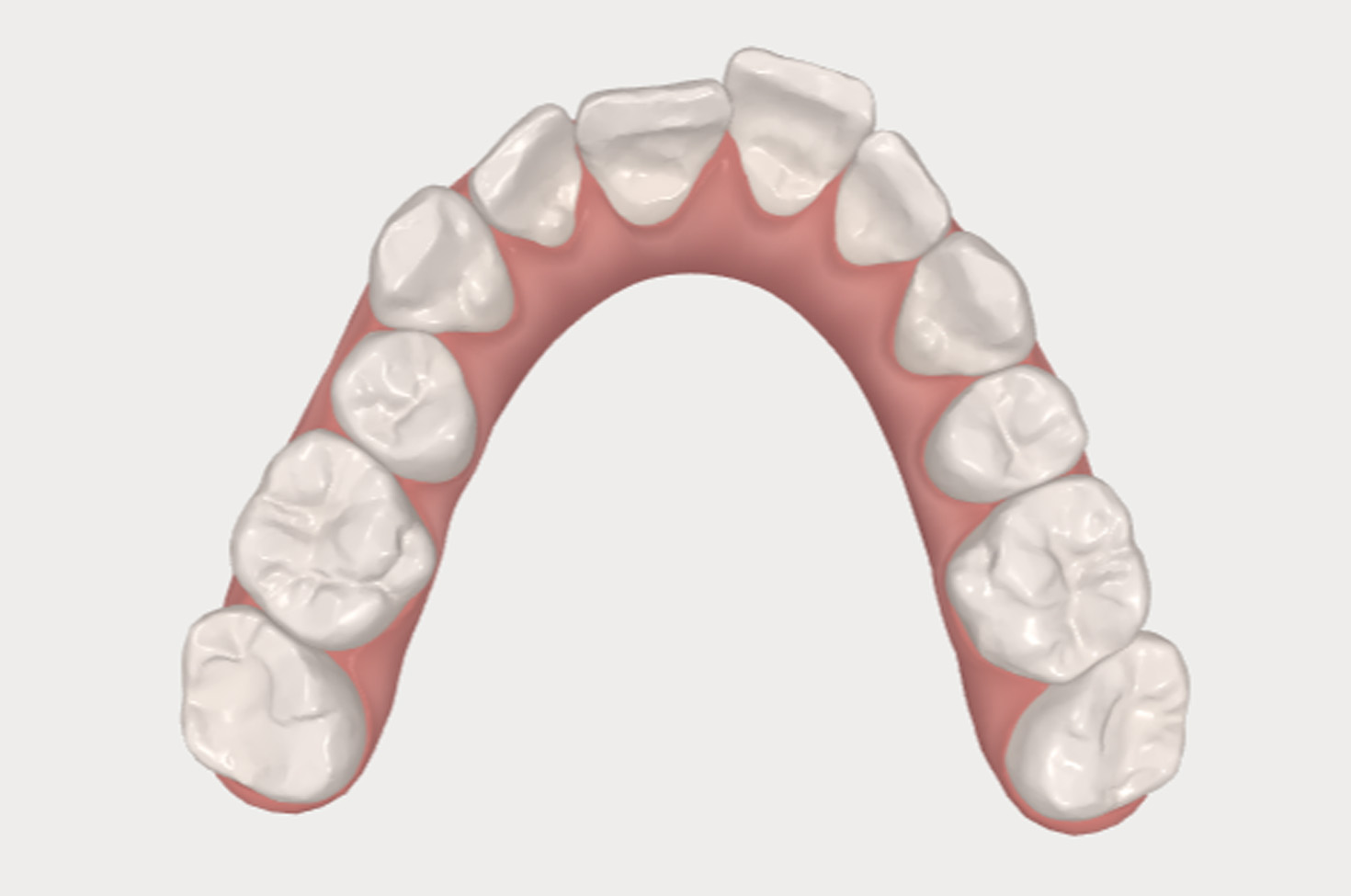 Invisalign – Restore Dental Group
